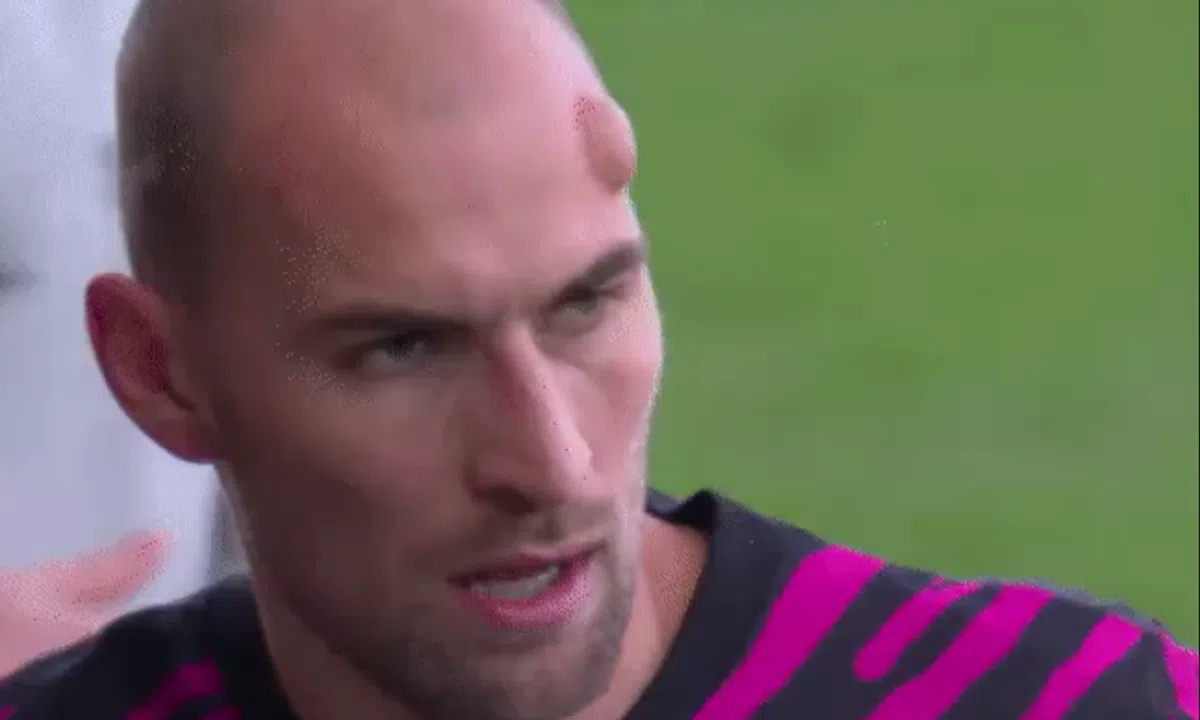 Harde botsing zorgt voor gigantisch ei op het voorhoofd van Bas Dost